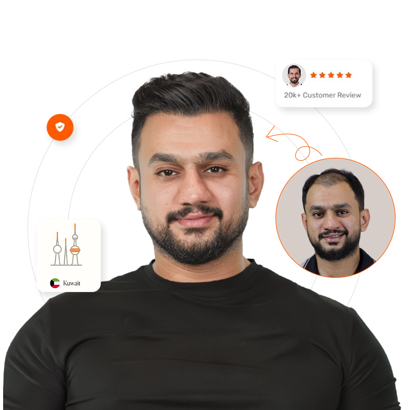 Hair Transplant in Kuwait | FUE Procedure for Natural Results